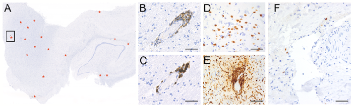 IgG4-TREAT - Projects